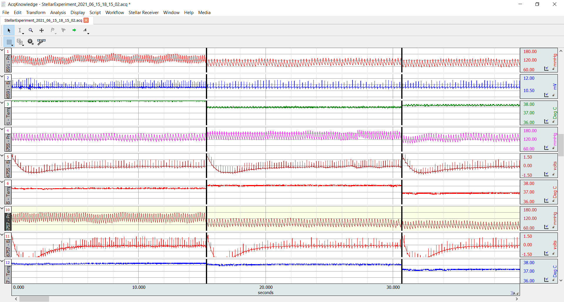 Stellar Telemetry - TSE Systems